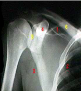 Radiología e Imagen para el Diagnóstico: Cintura Escapular